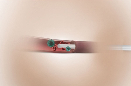 Clik-FIX Catheter Securement Devices - B. Braun
